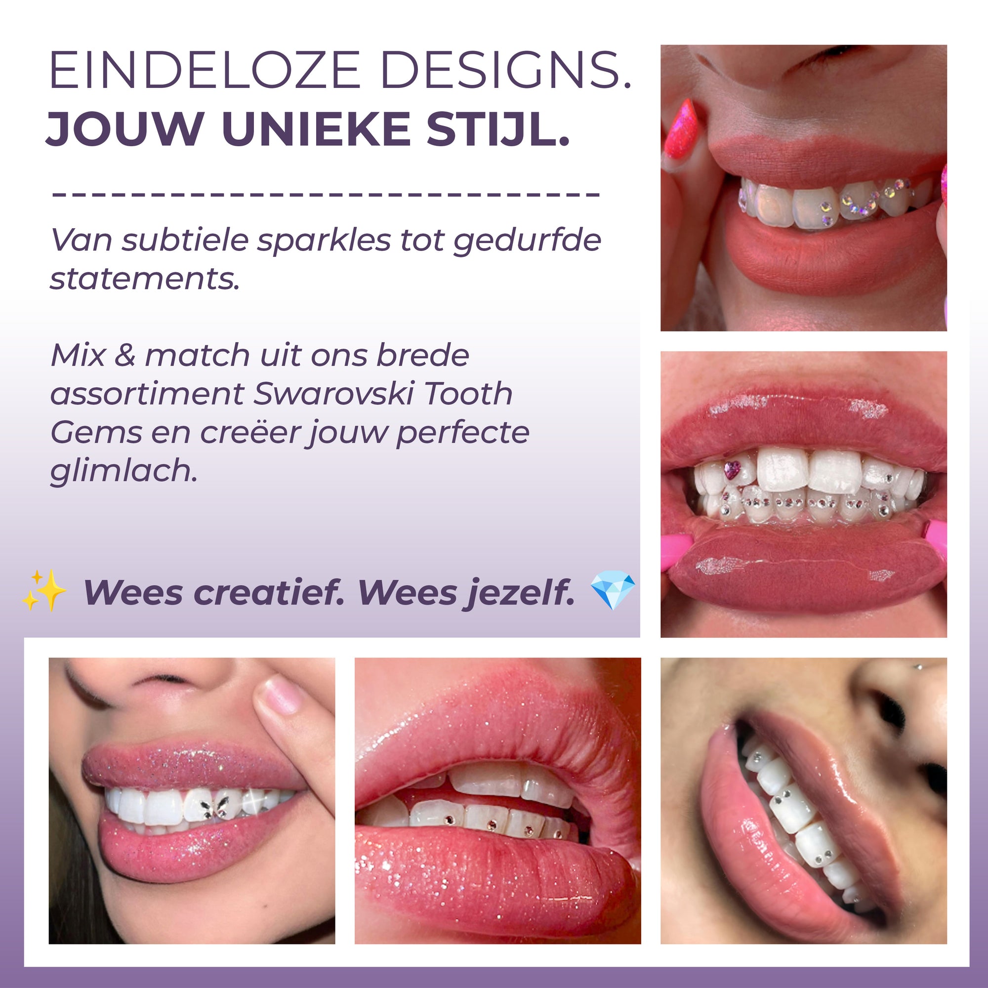 Tooth Gem Kit - Mix en Match Jouw Tooth Gems! | SelfGem