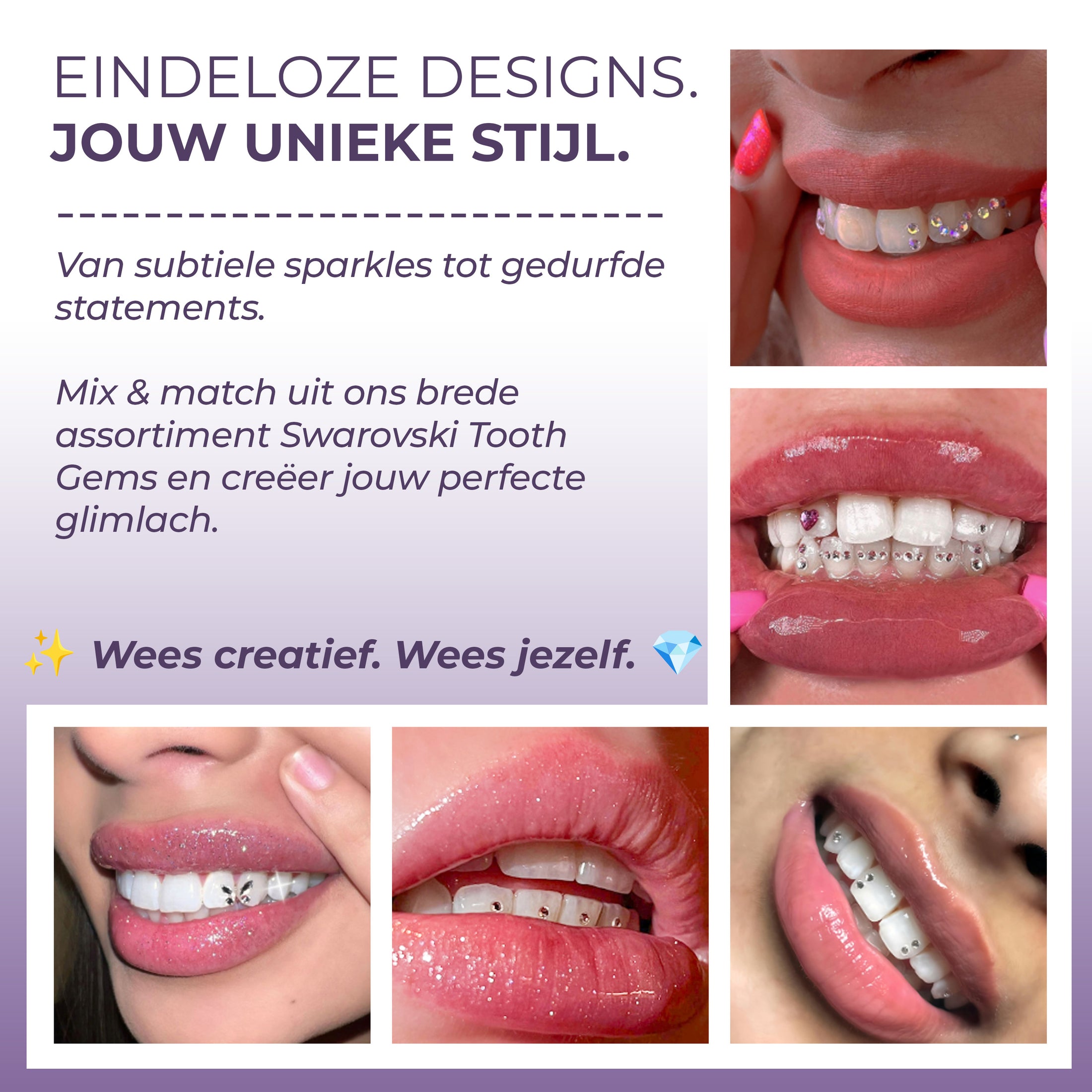 Tooth Gem Kit - Mix en Match Jouw Tooth Gems! | SelfGem